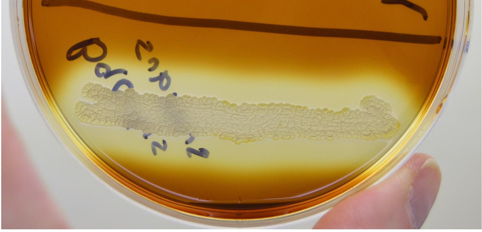 Solved Name the exoenzyme produced by this bacteria a. | Chegg.com
