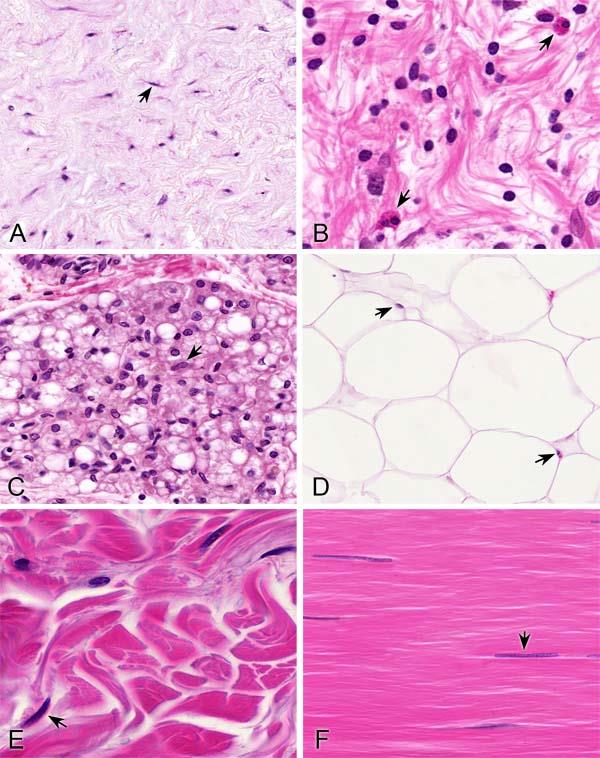 Solved Identify the connective tissues ! (ignore the | Chegg.com