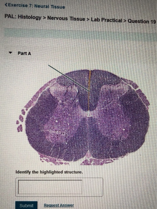Solved Exercise 7: Neural Tissue PAL: Histology > Nervous | Chegg.com