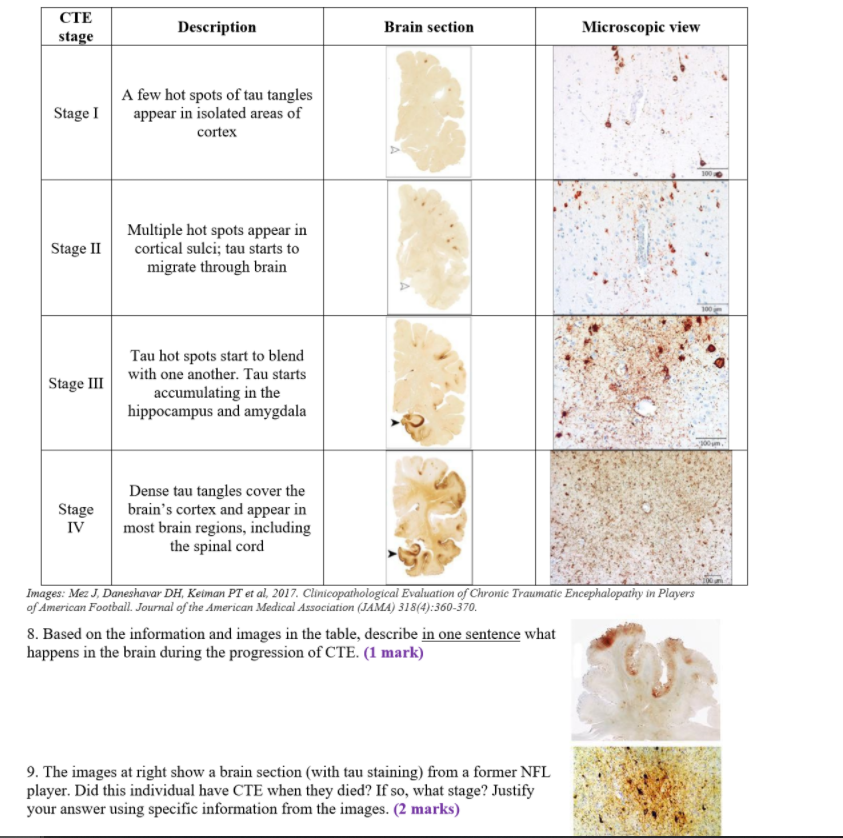 Chronic Traumatic Encephalopathy Stages