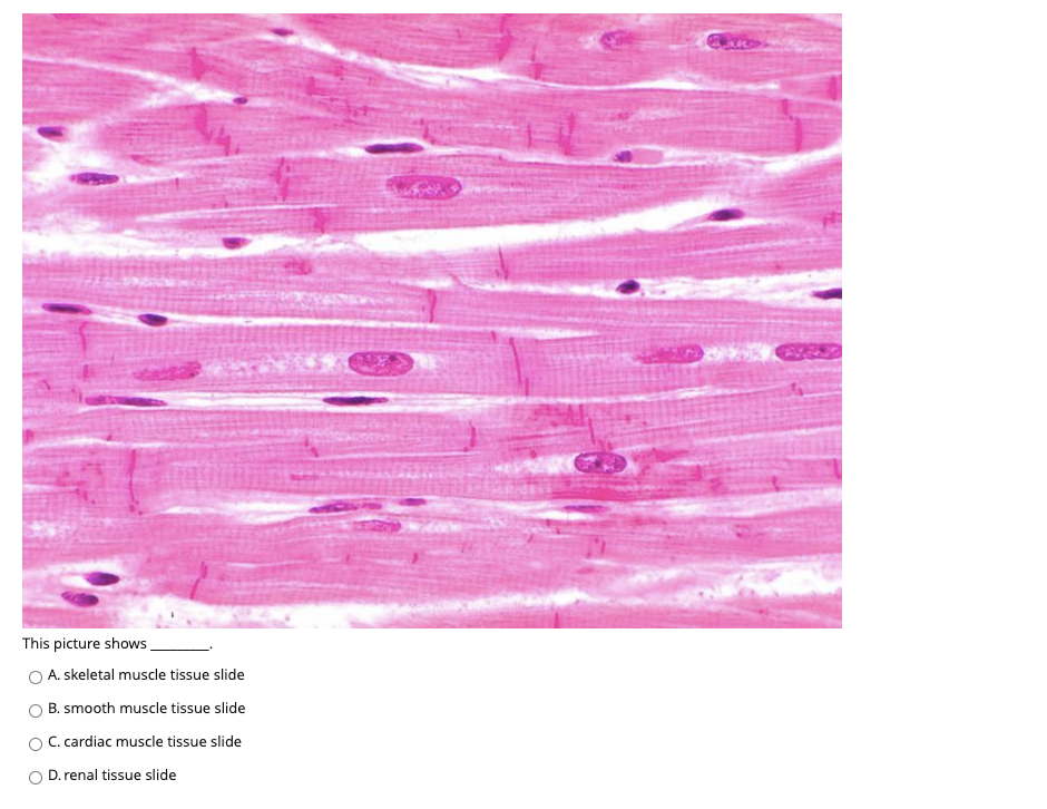 Skeletal Muscle Tissue Slide