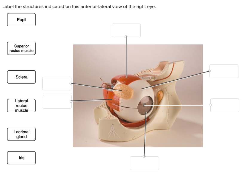 Solved Label the structures indicated on this | Chegg.com