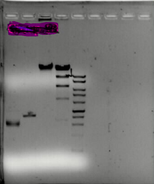 Solved I need help understanding the electrophoresis result | Chegg.com