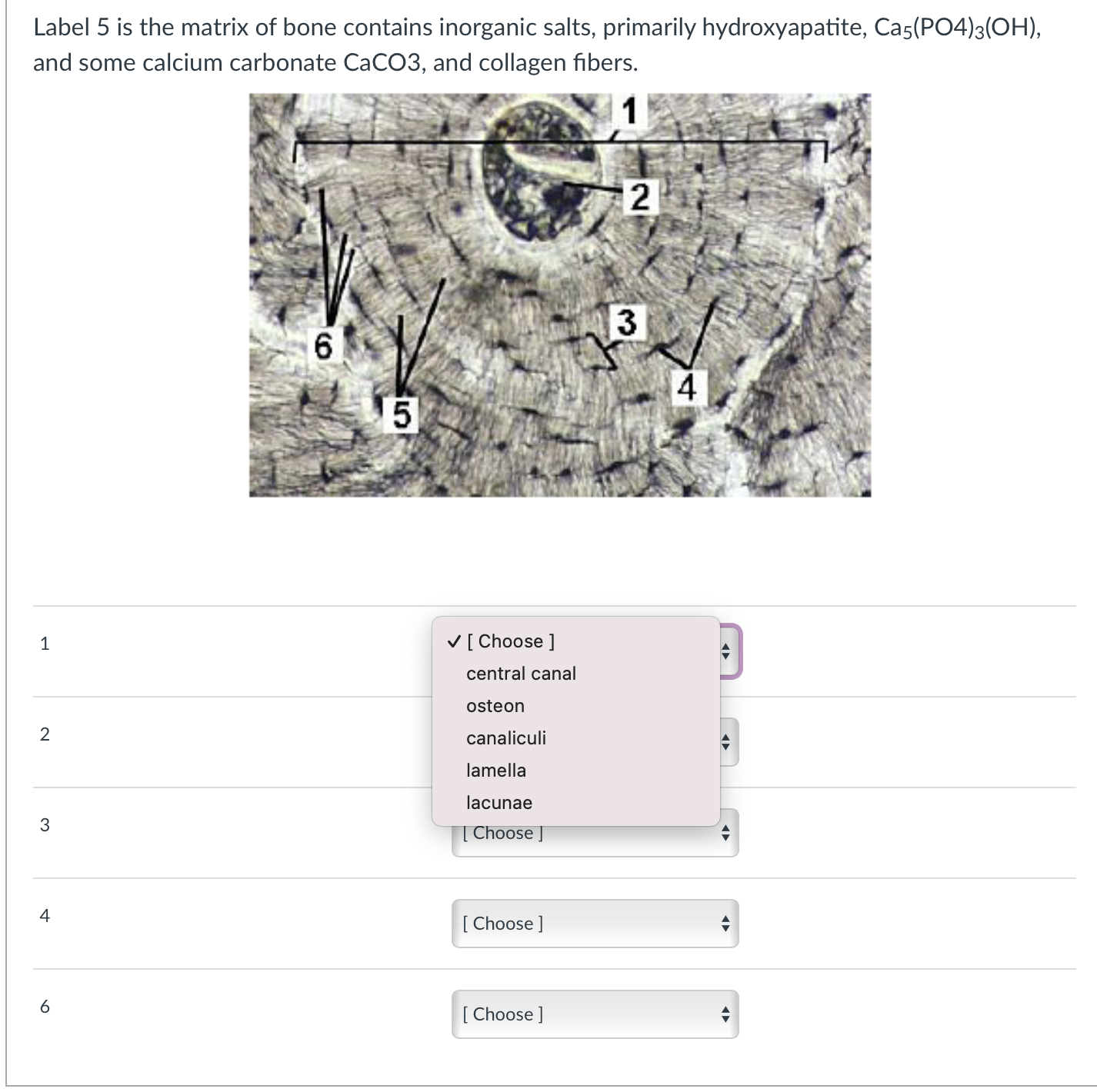 Solved Label 5 is the matrix of bone contains inorganic | Chegg.com
