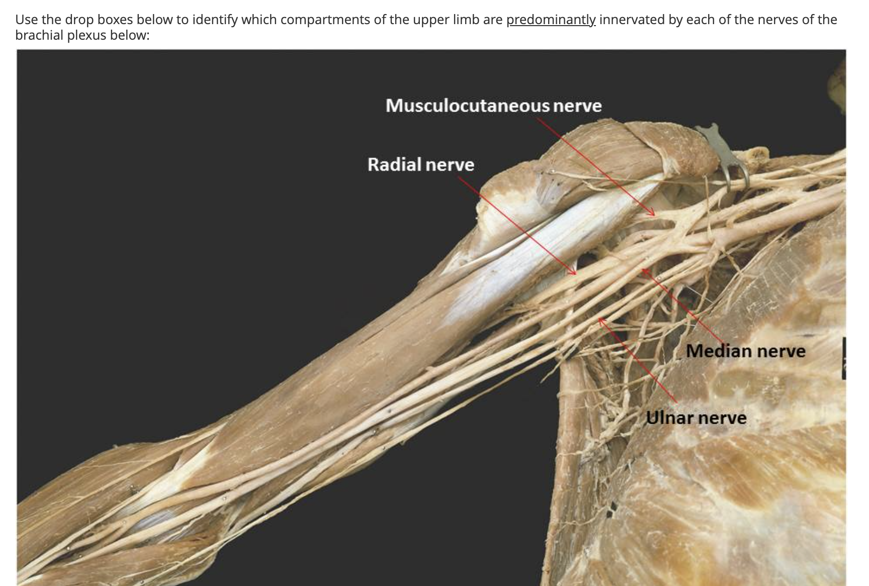 Solved Use the drop boxes below to identify which | Chegg.com
