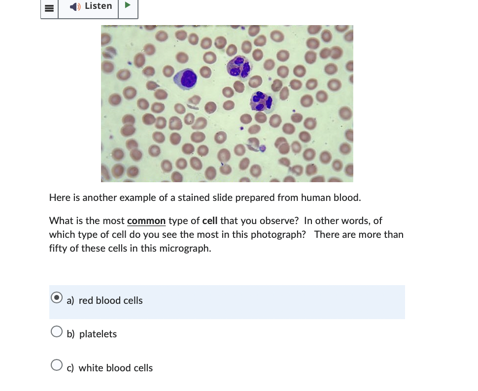 Solved In this example of a blood slide, how many white | Chegg.com
