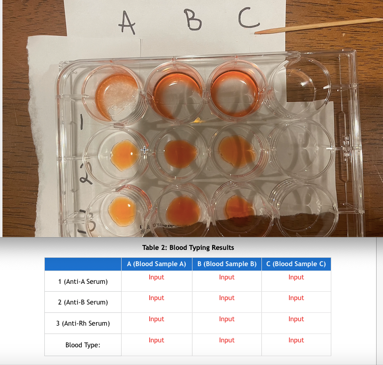 A (Blood Sample A) ﻿B (Blood Sample B) ﻿C (Blood | Chegg.com