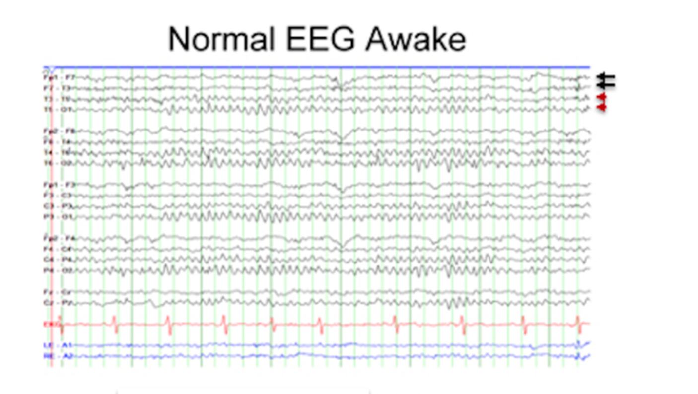 Solved Answer the following question regarding the healthy | Chegg.com