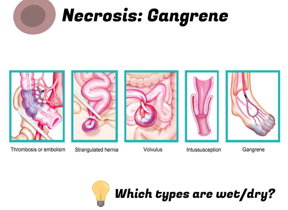 Solved Negrosis: Gangrene Thrombosis or embolism | Chegg.com