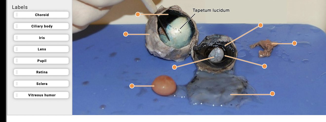Solved Labels Choroid Ciliary body Iris Lens Pupil Retina | Chegg.com