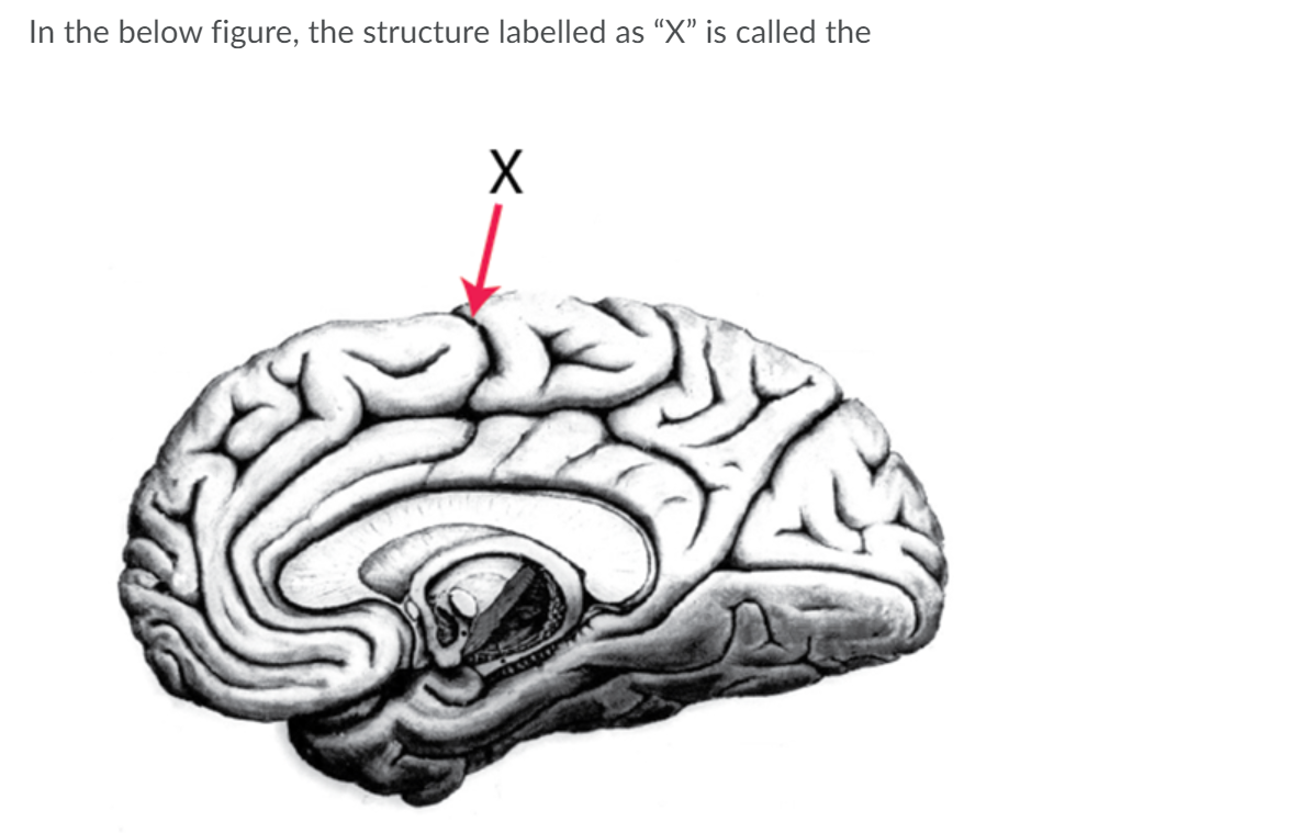 Solved In the below figure, the structure labelled as “X”is | Chegg.com