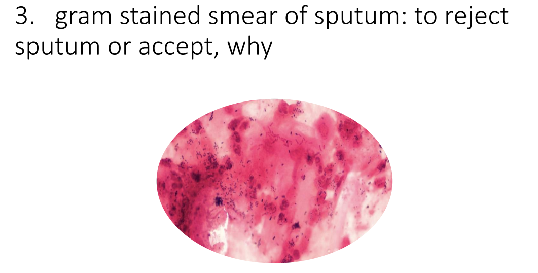Solved 3. gram stained smear of sputum: to reject sputum or | Chegg.com