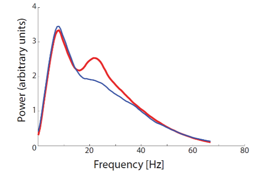 Solved Spectral analysis and Brain rhythms (3 pnts): | Chegg.com