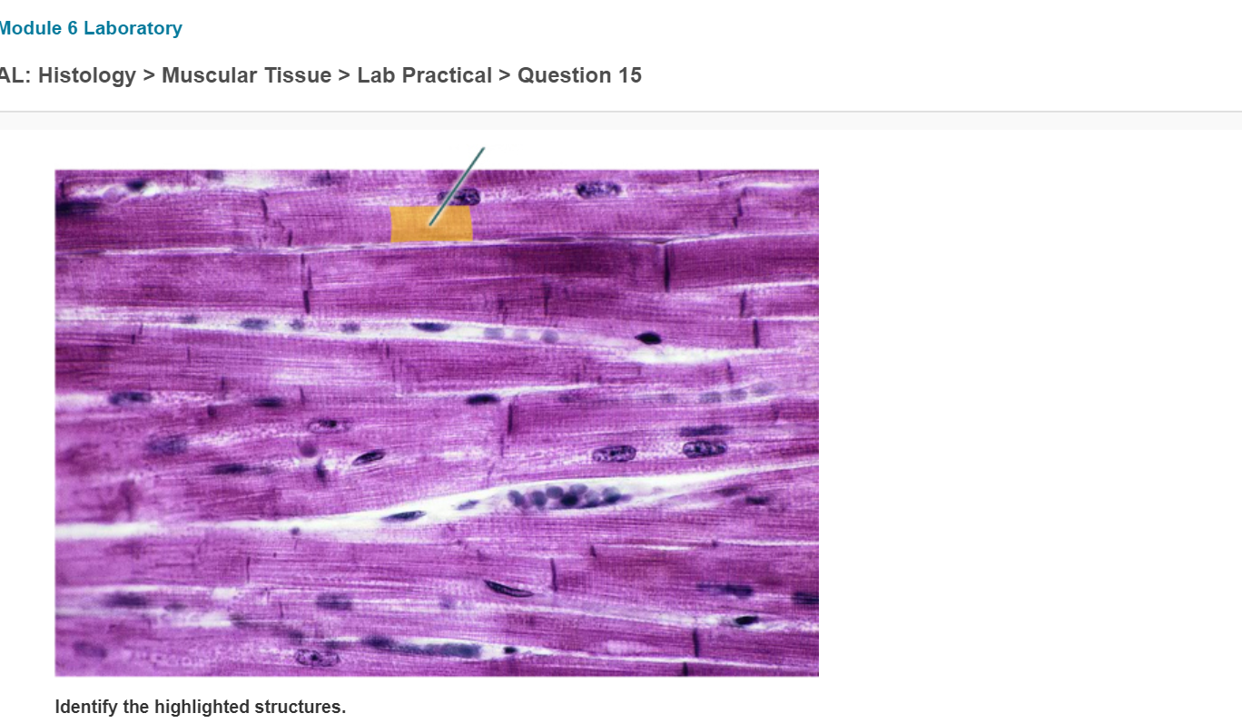 Solved Module 6 Laboratory AL: Histology > Muscular Tissue > | Chegg.com