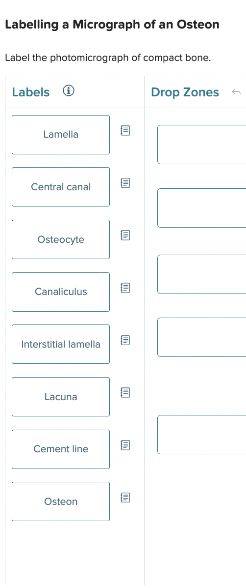 Solved Labelling a Micrograph of an OsteonLabel the | Chegg.com