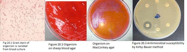 Solved Fig 20.1 Gram stain of organism is isolated from | Chegg.com