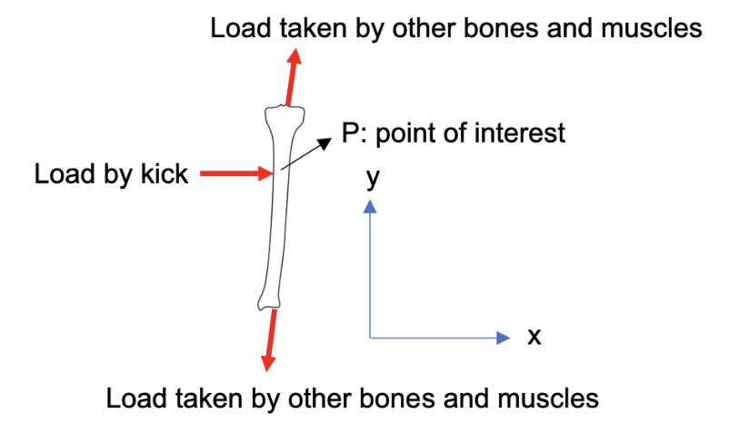 Solved Consider a soccer player gets a hard kick in the leg | Chegg.com