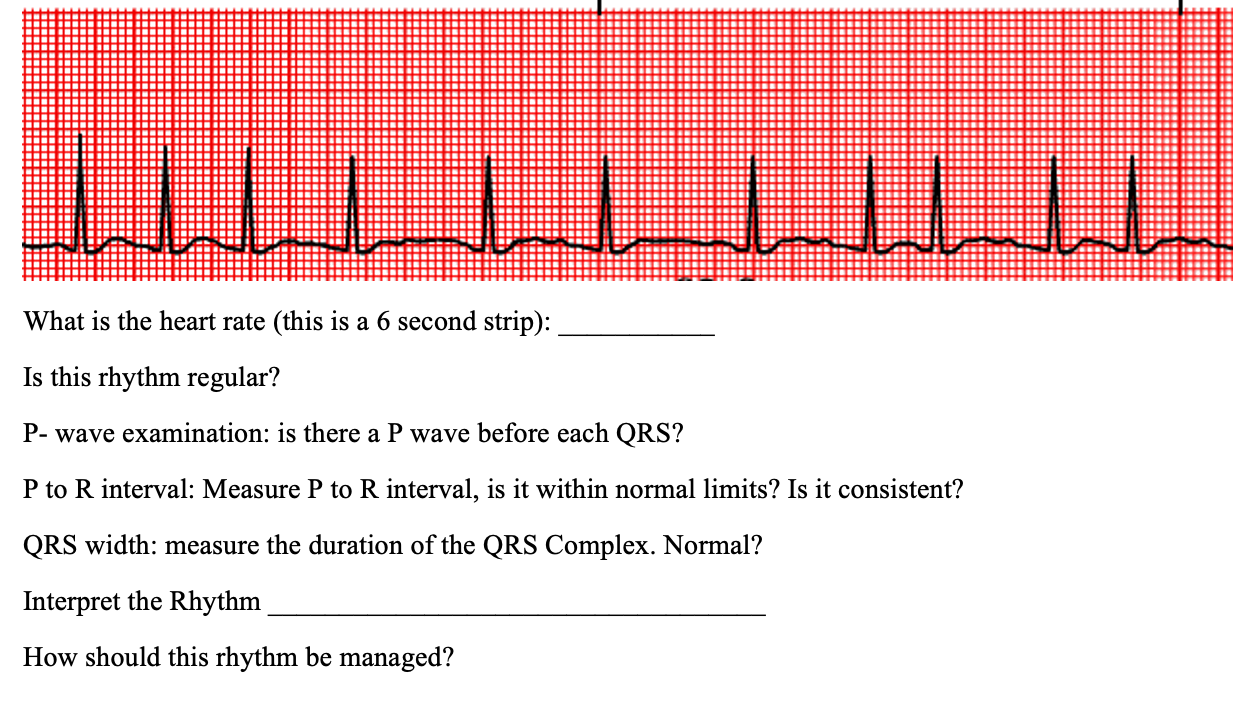 Solved What is the heart rate (this is a 6 ﻿second strip):Is | Chegg.com