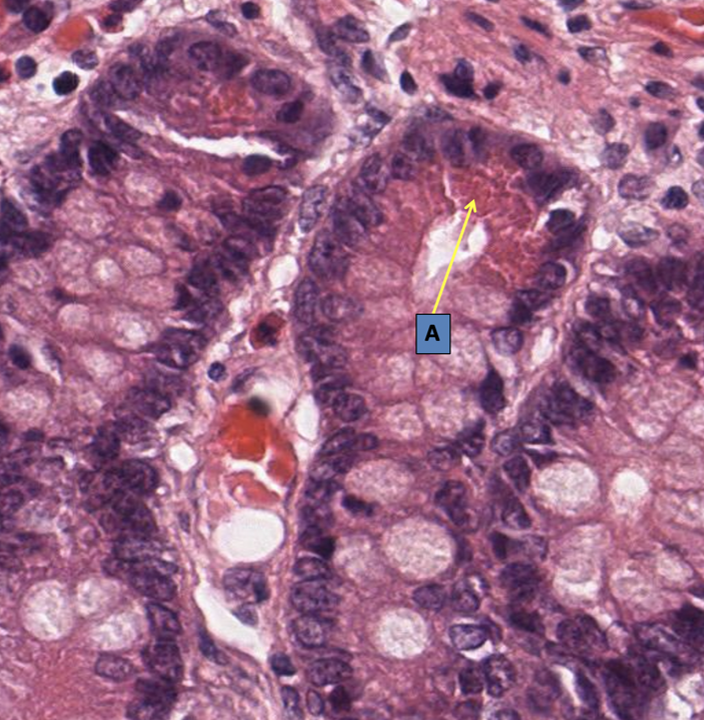 Solved A. These types of cells can be found in the cecum | Chegg.com