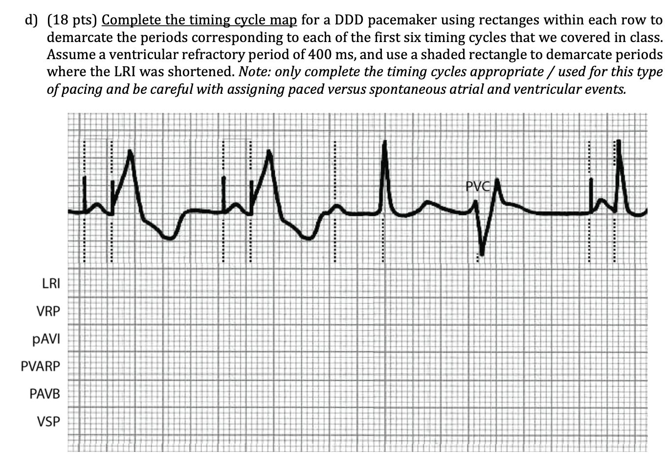 d) (18 pts) Complete the timing cycle map for a DDD | Chegg.com