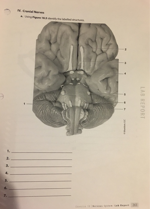 Solved III. Brain Structures Using Figure 18.4 identify the | Chegg.com