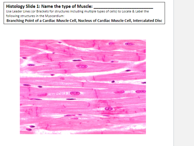 Cardiac Muscle Cell Structure Branching