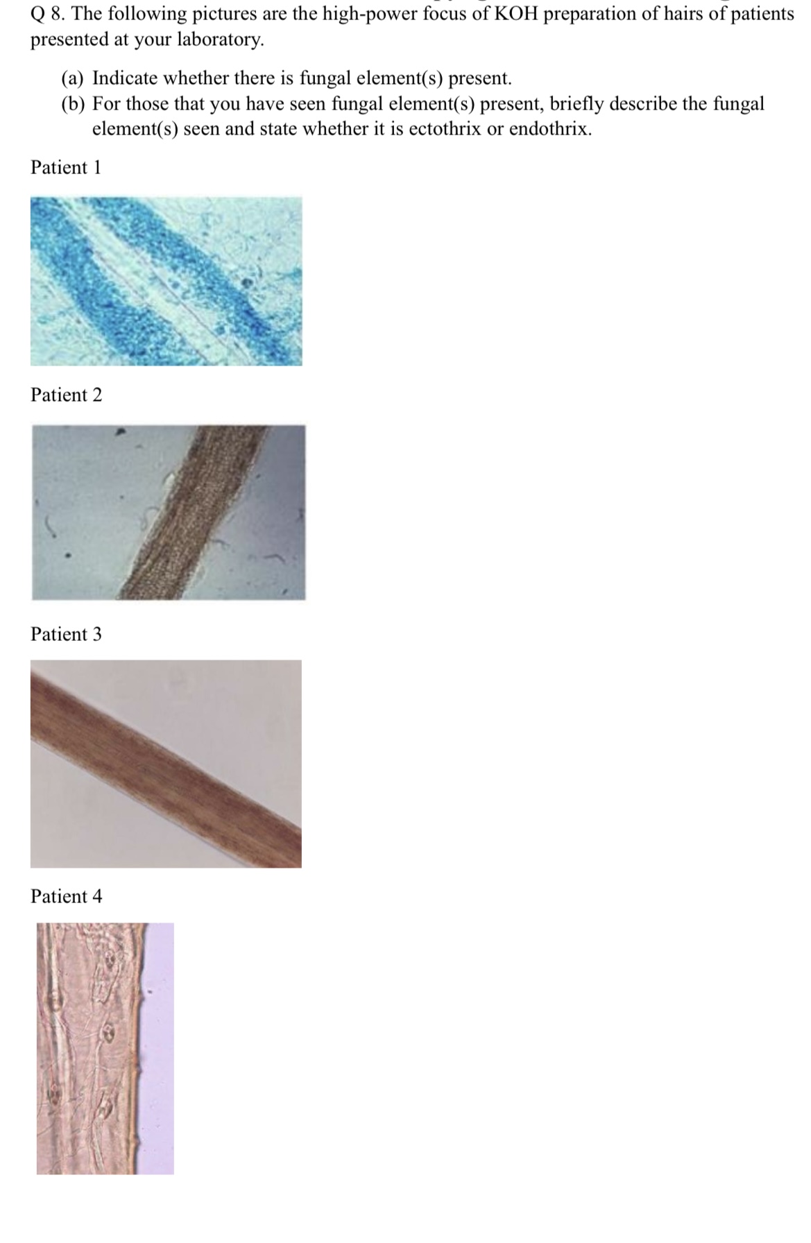 Solved Q 8. ﻿The following pictures are the high-power focus | Chegg.com