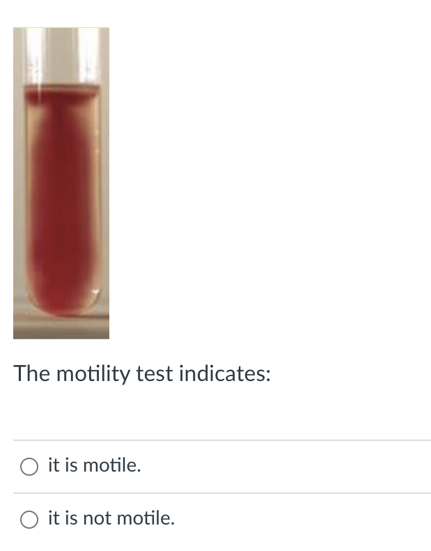 Solved The motility test indicates: it is motile. O it is | Chegg.com