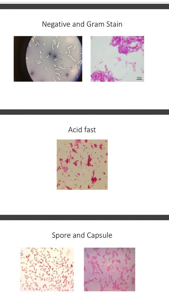 Bacillus Stearothermophilus Gram Stain
