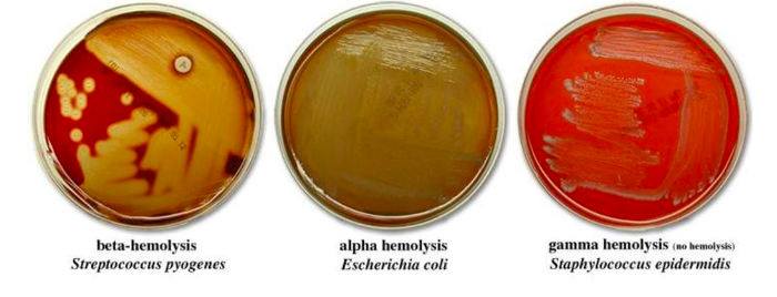 Solved beta-hemolysis Streptococcus pyogenes alpha | Chegg.com