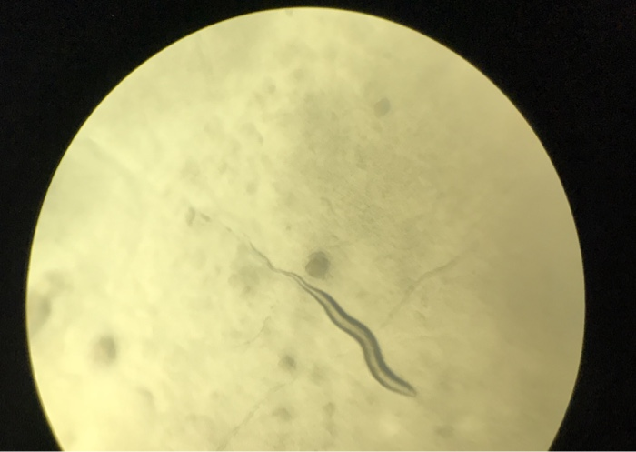 Solved Pictures of mutant dpy-11 c. Elegans. Please tell me | Chegg.com