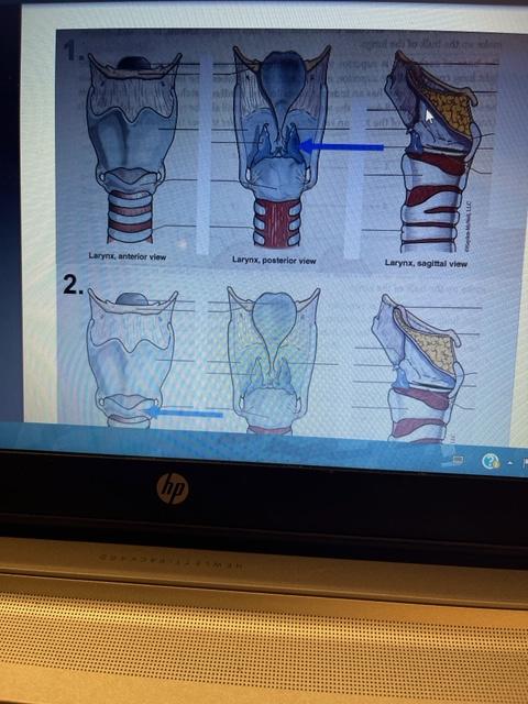Solved Larynx, anterior view Larynx, posterior view Larynx, | Chegg.com