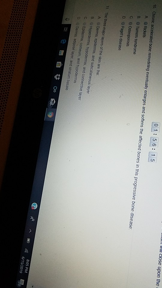 Solved EC demauts may be caused by A OViral infections or a | Chegg.com