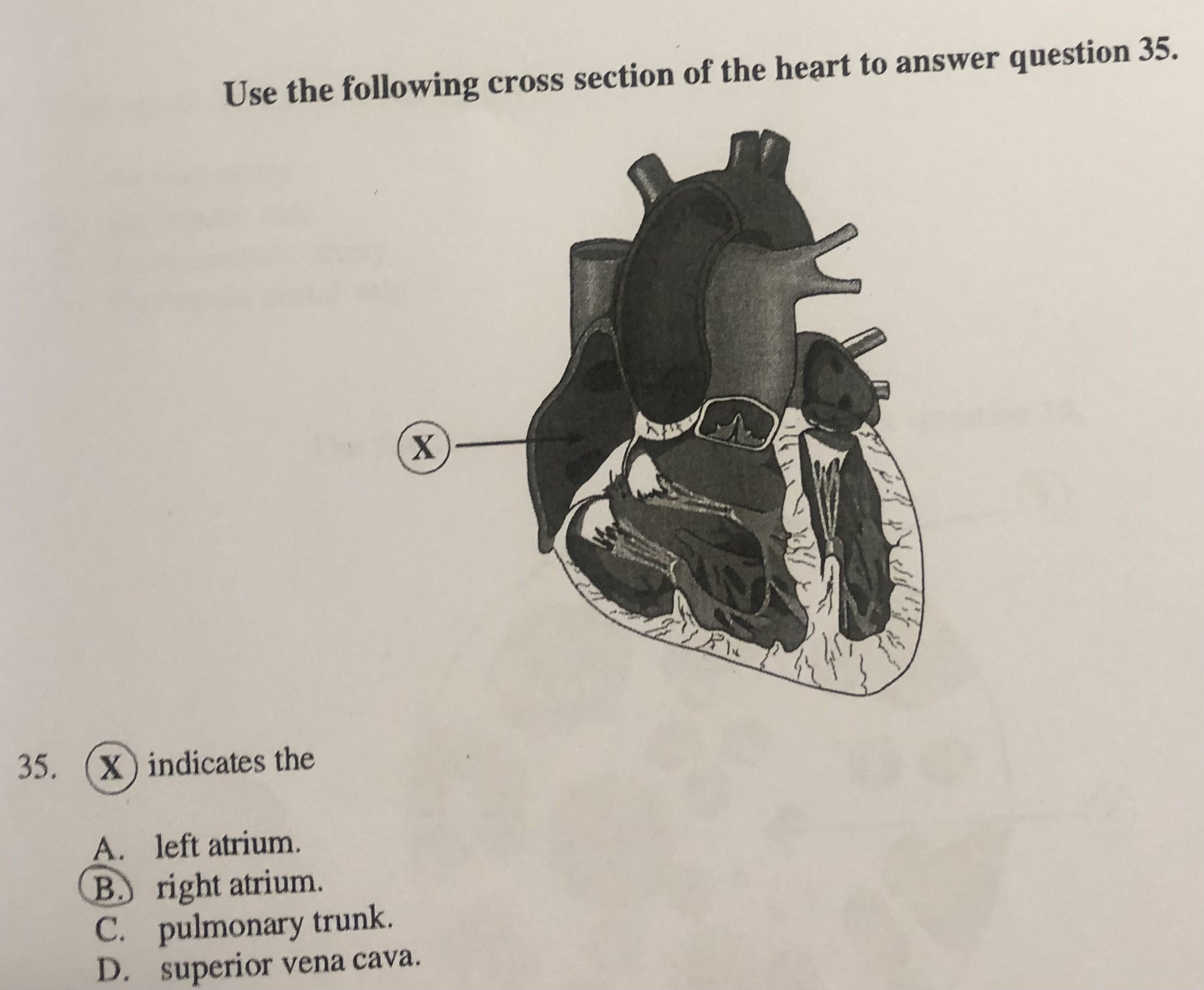 Solved Use the following cross section of the heart to | Chegg.com