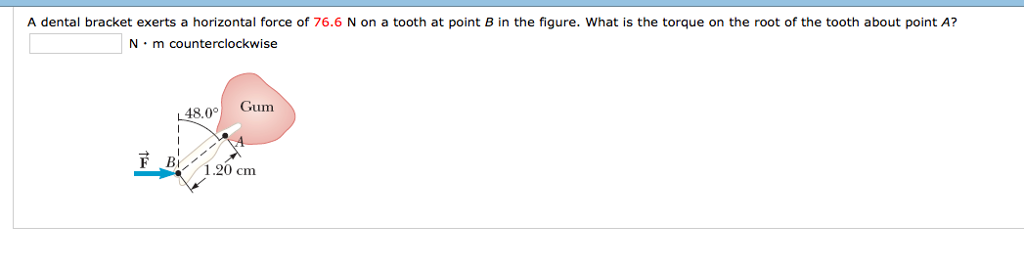 Solved A dental bracket exerts a horizontal force of 76.6 N | Chegg.com