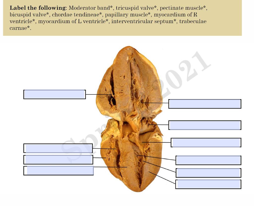Solved Label the following: Moderator band*, tricuspid | Chegg.com