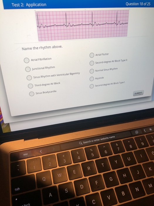Solved Test 2: Application Question 18 of 25 Name the rhythm | Chegg.com