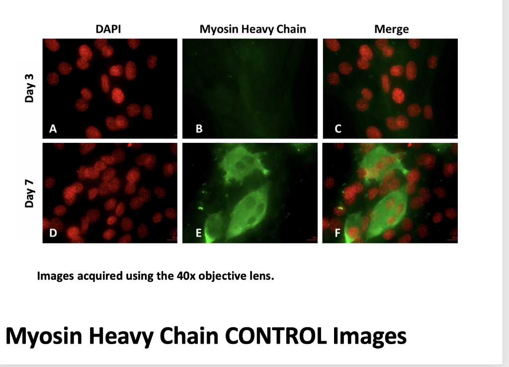 Solved DAPI PCNA Merge Day 3 A B C Day 7 D E F Images | Chegg.com