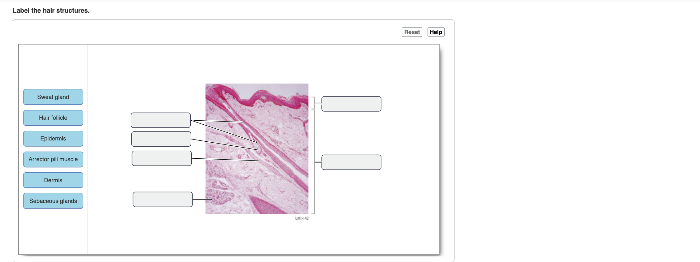 Solved Label the hair structures. | Chegg.com