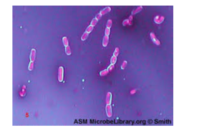 Solved ASM MicrobeLibrary.org Smith A student used a | Chegg.com
