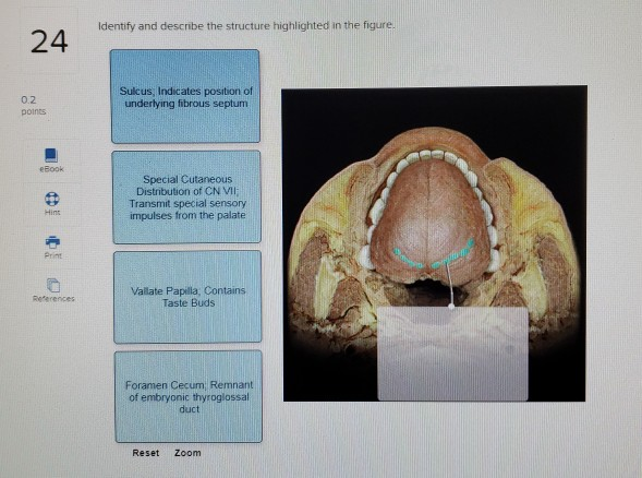 Solved Identify and describe the structure highlighted in | Chegg.com