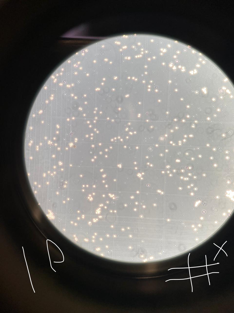 Counting trypsinized cells (with 5% & 10% ethanol) on | Chegg.com