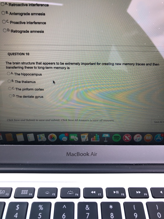 Solved OB. Anterograde amnesia OC Proactive interference OD. | Chegg.com