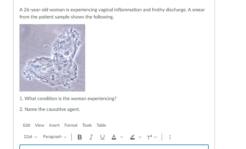 Solved A 26-year-old woman is experiencing vaginal | Chegg.com