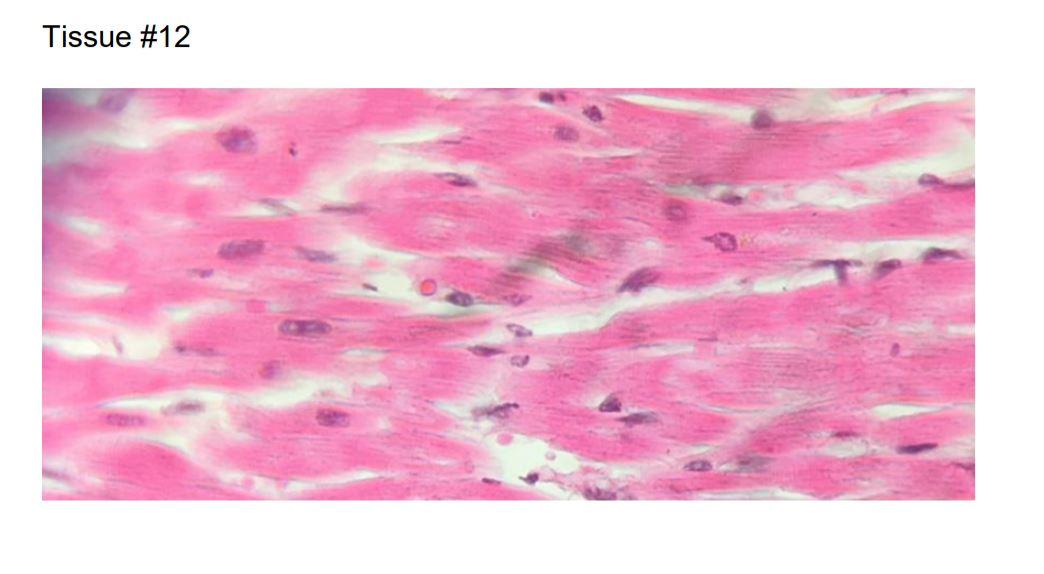 Solved Tissue #12 Tissue #15 | Chegg.com