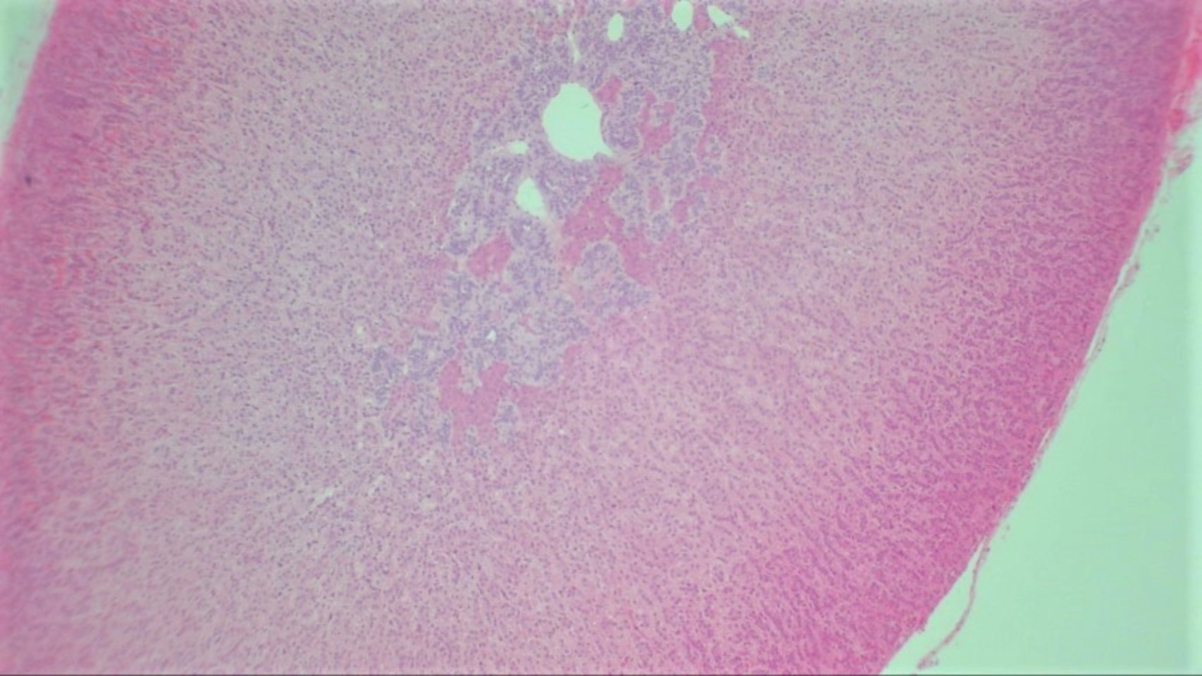 Solved This is a slide of adrenal gland. Could you please | Chegg.com