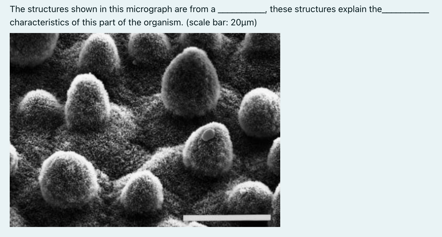 Solved The structures shown in this micrograph are from a | Chegg.com