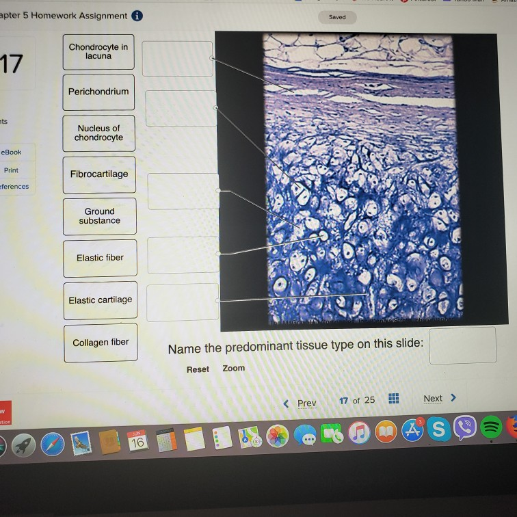 Solved apter 5 Homework Assignment Saved Chondrocyte in | Chegg.com Solved apter 5 Homework Assignment Saved Chondrocyte in | Chegg.com