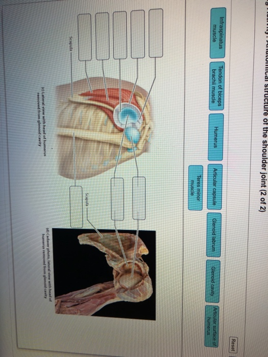 Solved aoal gructure of the shoulder joint (2 of 2) of bi | Chegg.com