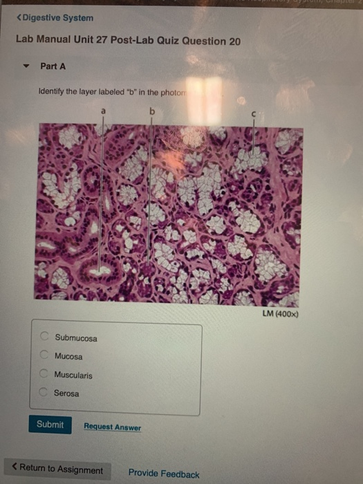 Solved Digestive System Lab Manual Unit 27 Post Lab Quiz Chegg